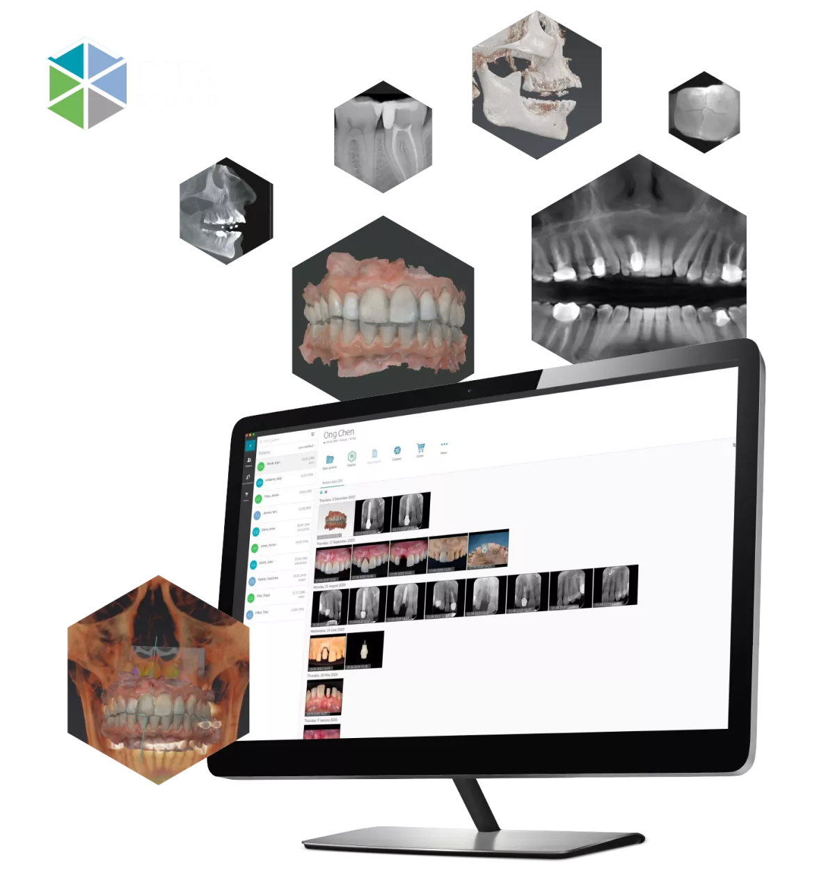 DTX Studio Clinic | DEXIS